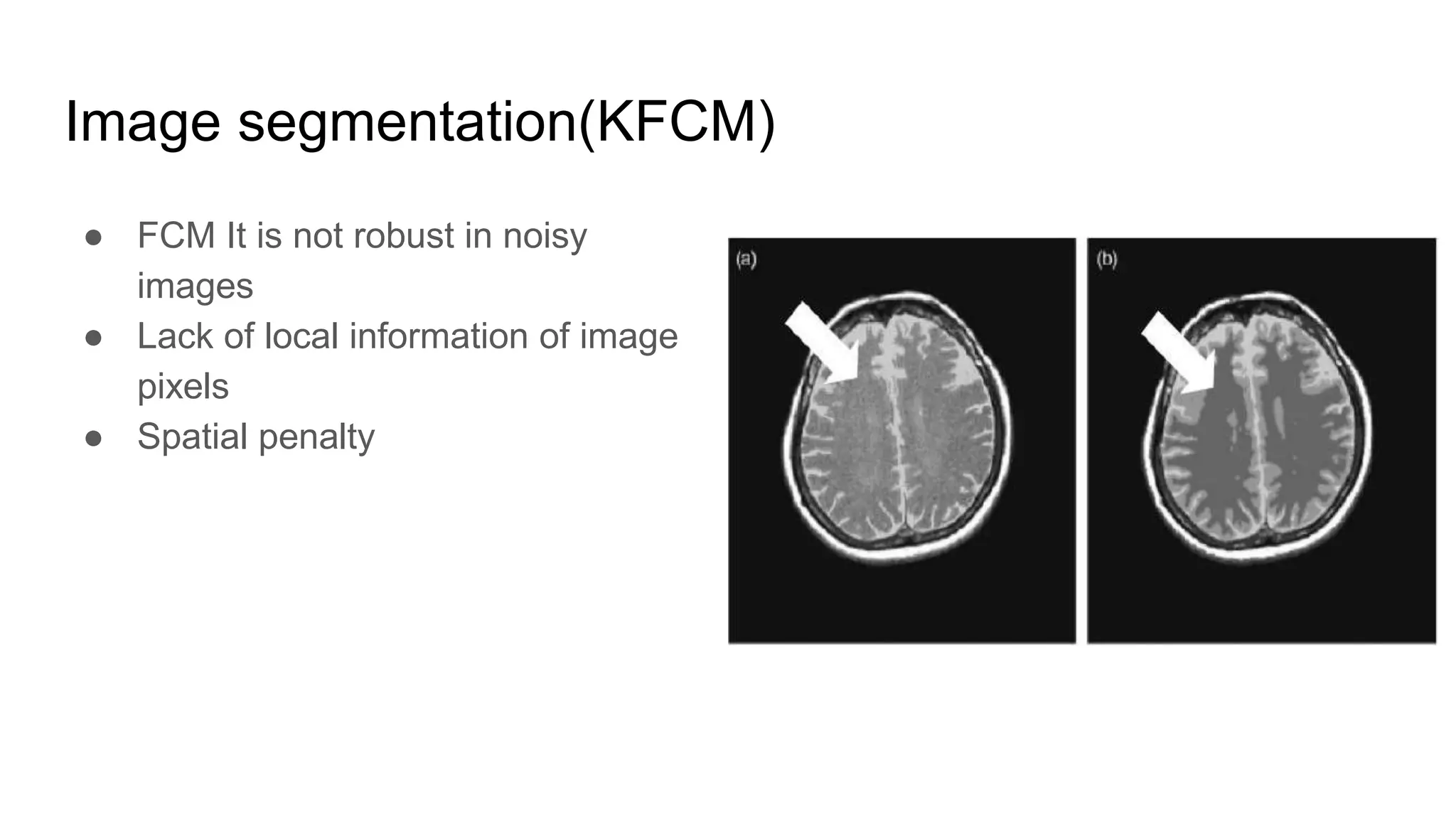 Fuzzy Clusteringc Means K Means Ppt 