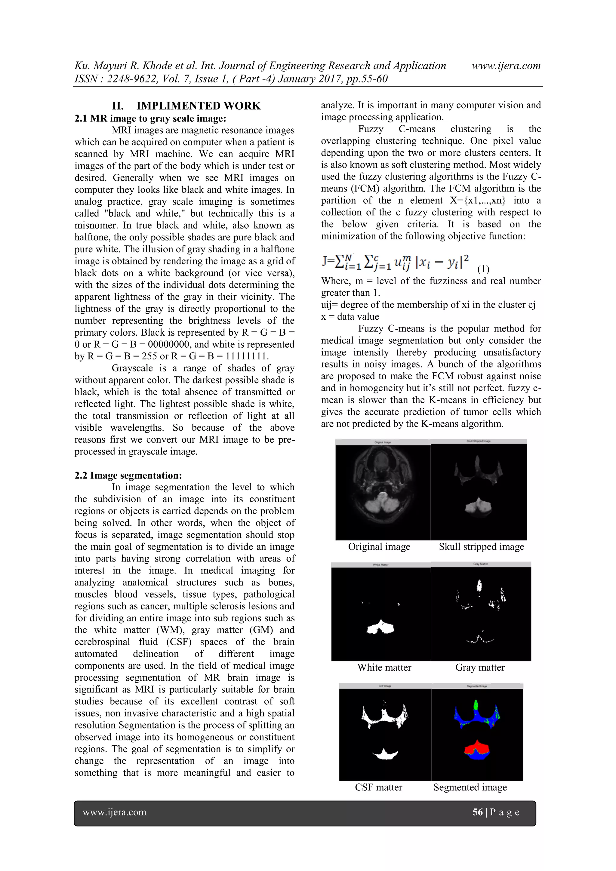 Efficient Brain Tumor Detection Using Wavelet Transform Pdf 0927