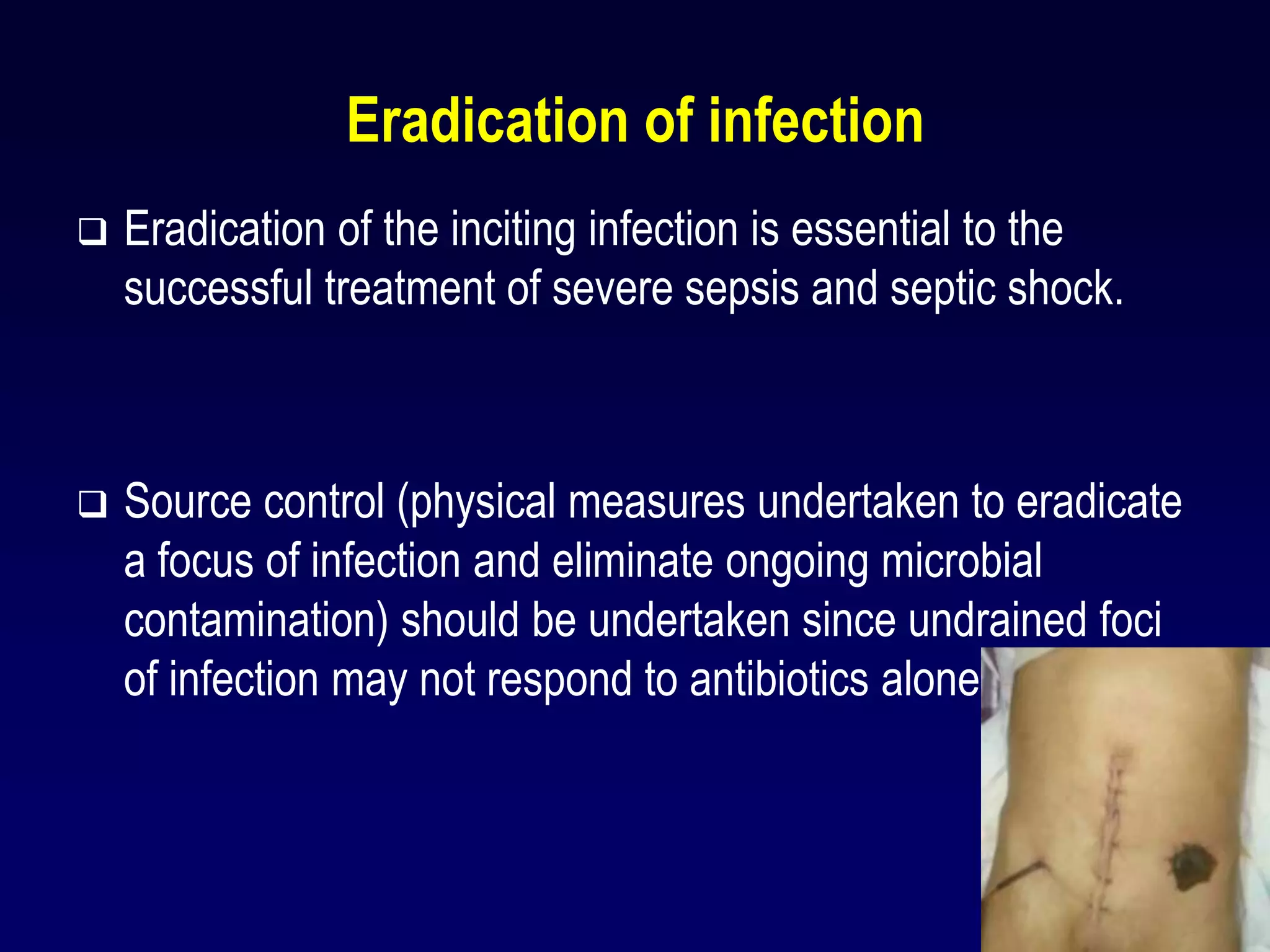 K148. Prinsip source control pada sepsis and The Sepsis Guideline.ppt