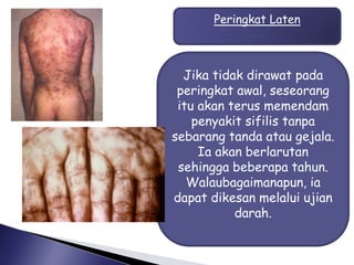 Syphilis aka Sifilis - Komunikasi Kesihatan | PPTX