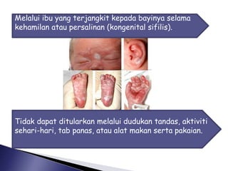 Syphilis aka Sifilis - Komunikasi Kesihatan | PPTX