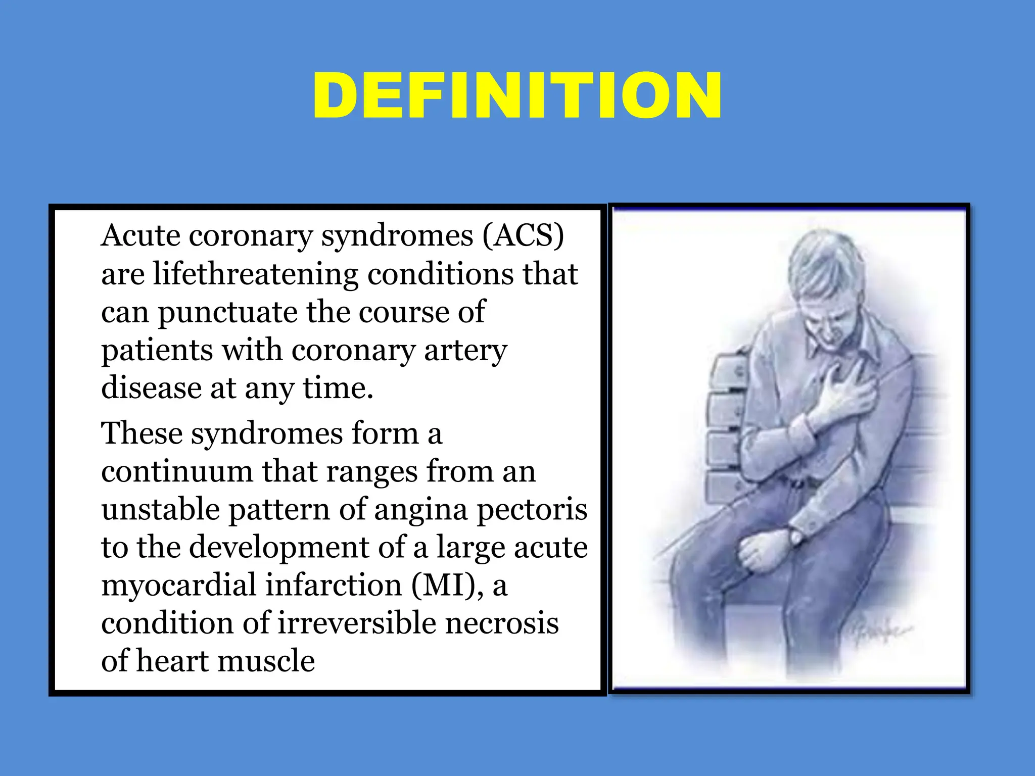 Acute Coronary Syndrome Slide kuliah CVS | PPTX