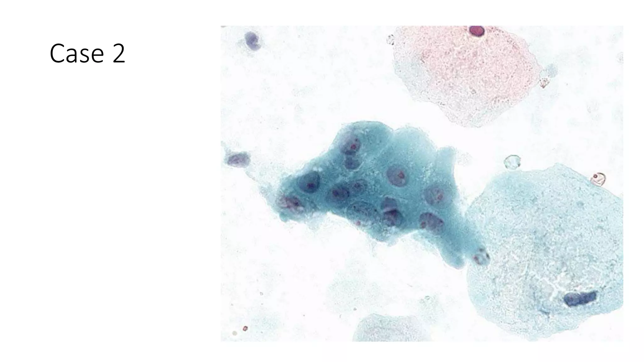 Dr._Ameli._case_presentation_urinary_cytology.pptx