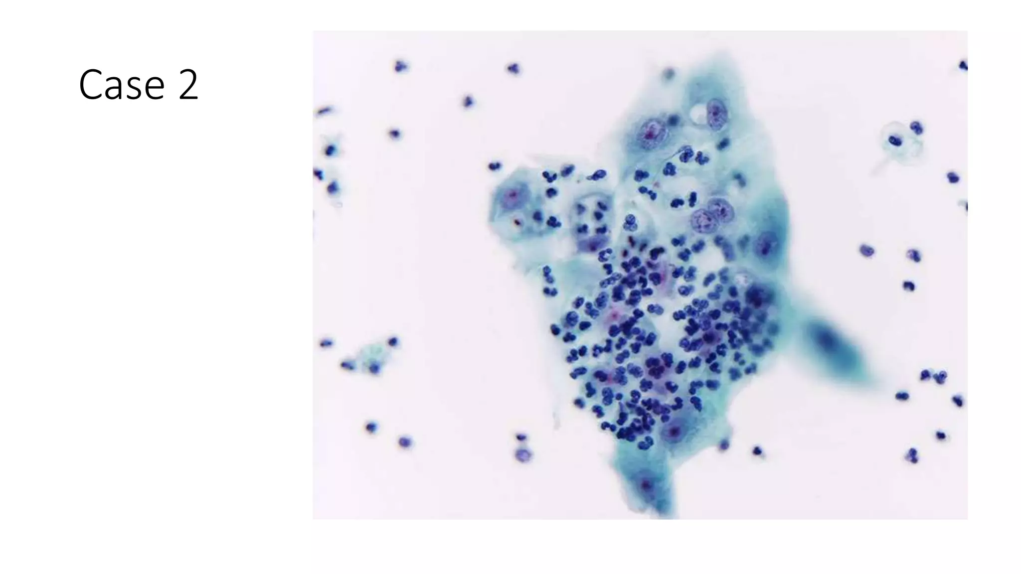 Dr._Ameli._case_presentation_urinary_cytology.pptx