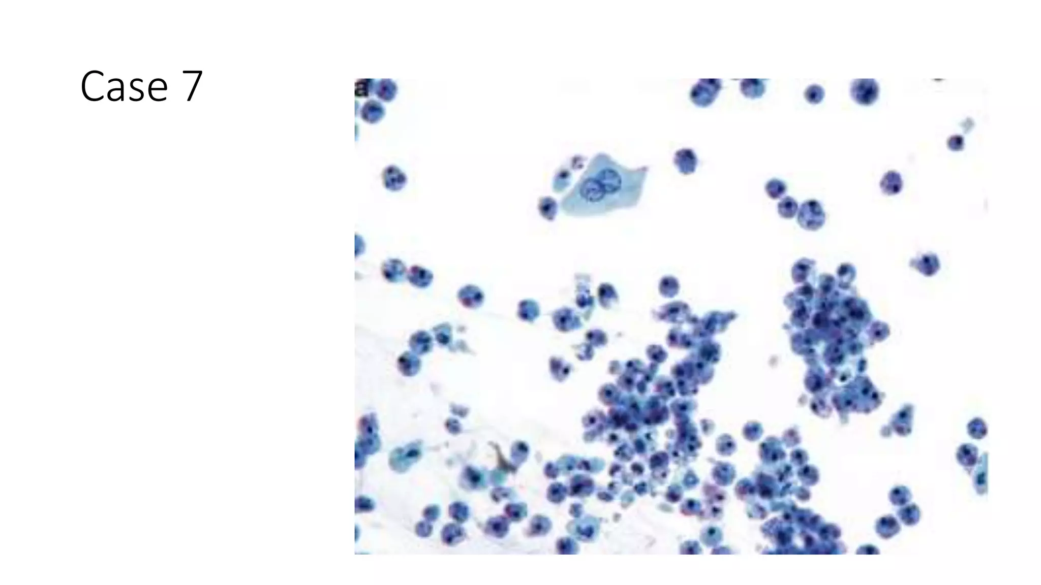 Dr._Ameli._case_presentation_urinary_cytology.pptx