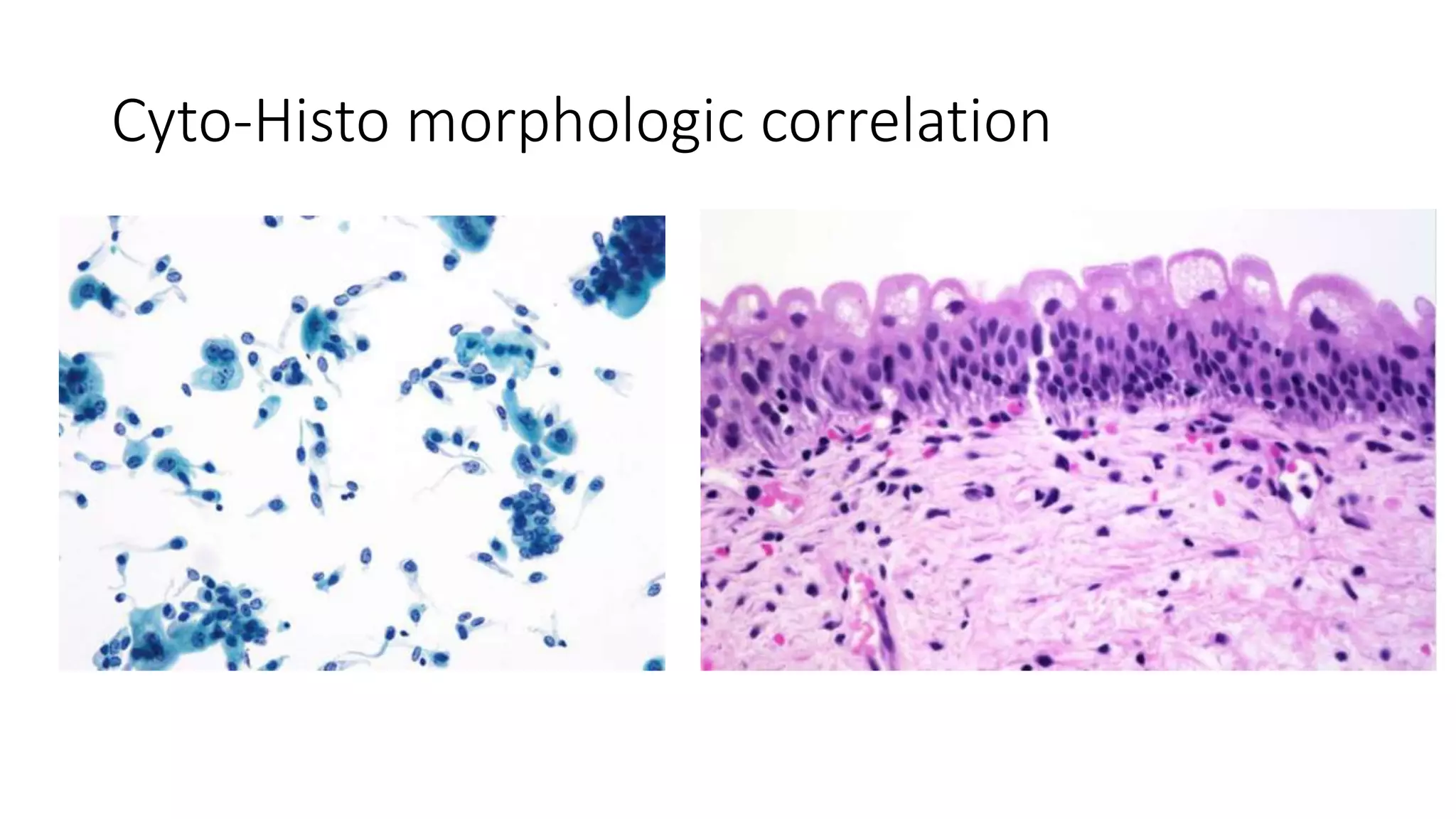 Dr._Ameli._case_presentation_urinary_cytology.pptx