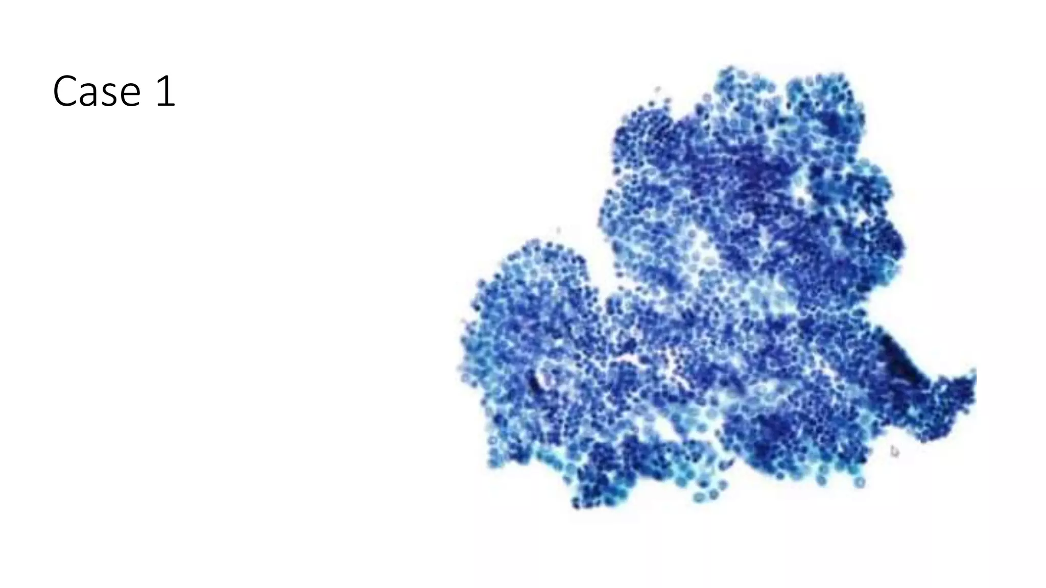 Dr._Ameli._case_presentation_urinary_cytology.pptx