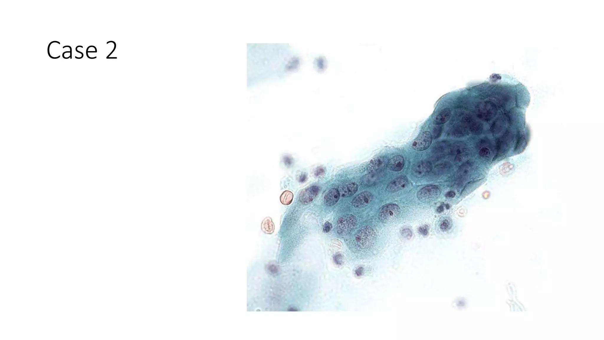 Dr._Ameli._case_presentation_urinary_cytology.pptx