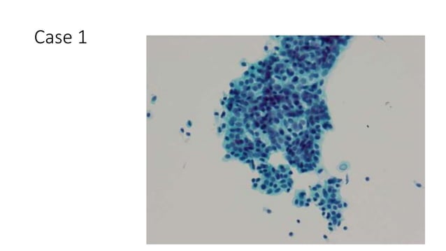 Dr._Ameli._case_presentation_urinary_cytology.pptx