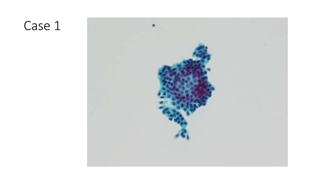 Dr._Ameli._case_presentation_urinary_cytology.pptx