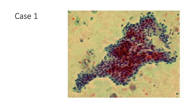 Dr._Ameli._case_presentation_urinary_cytology.pptx