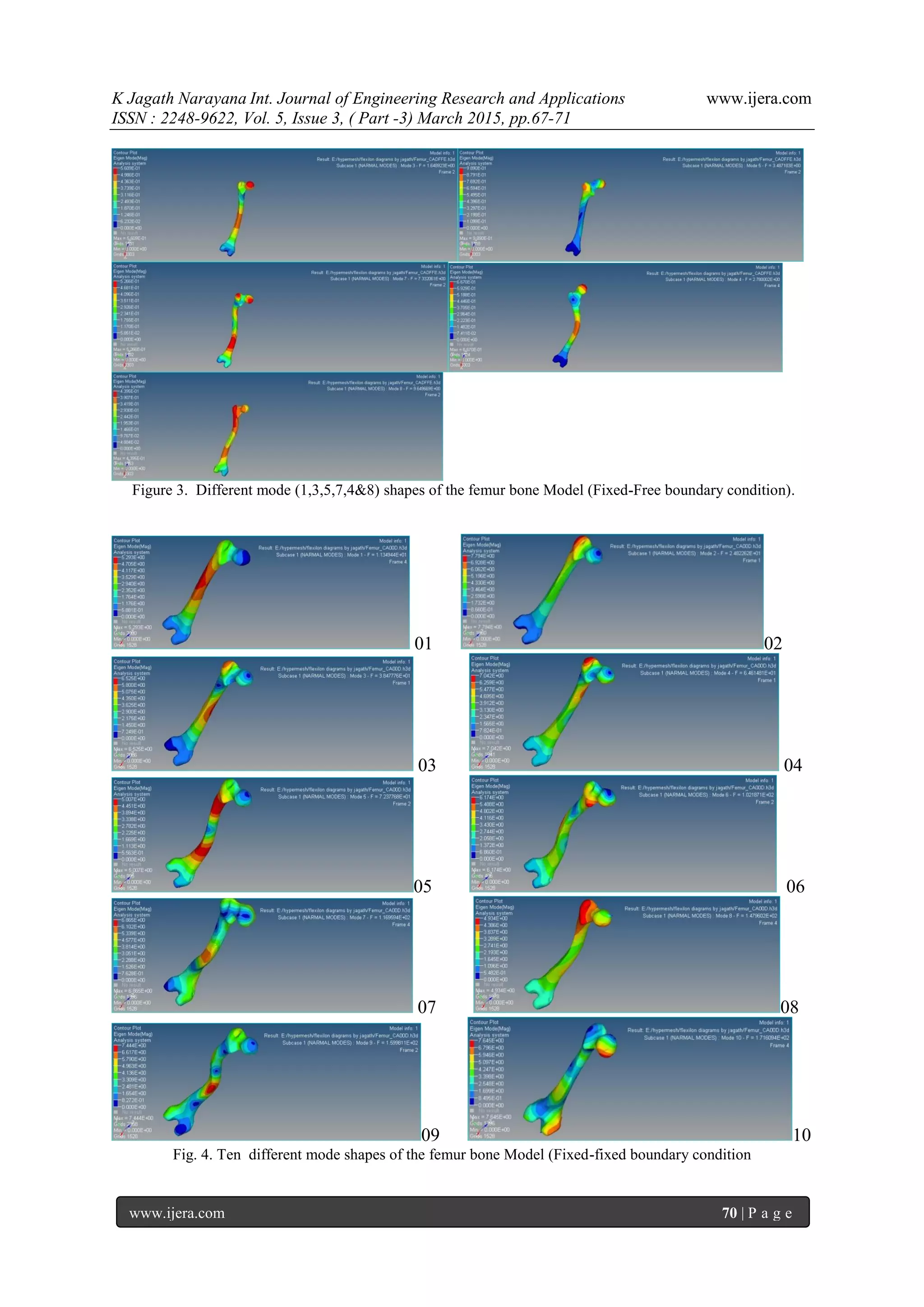 Natural Vibration Analysis of Femur Bone Using Hyperworks | PDF