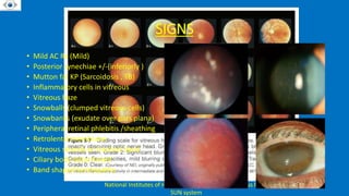 INTERMEDIATE_UVEITIS presentation dhir hospital bhiwani.pptx