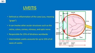 INTERMEDIATE_UVEITIS presentation dhir hospital bhiwani.pptx