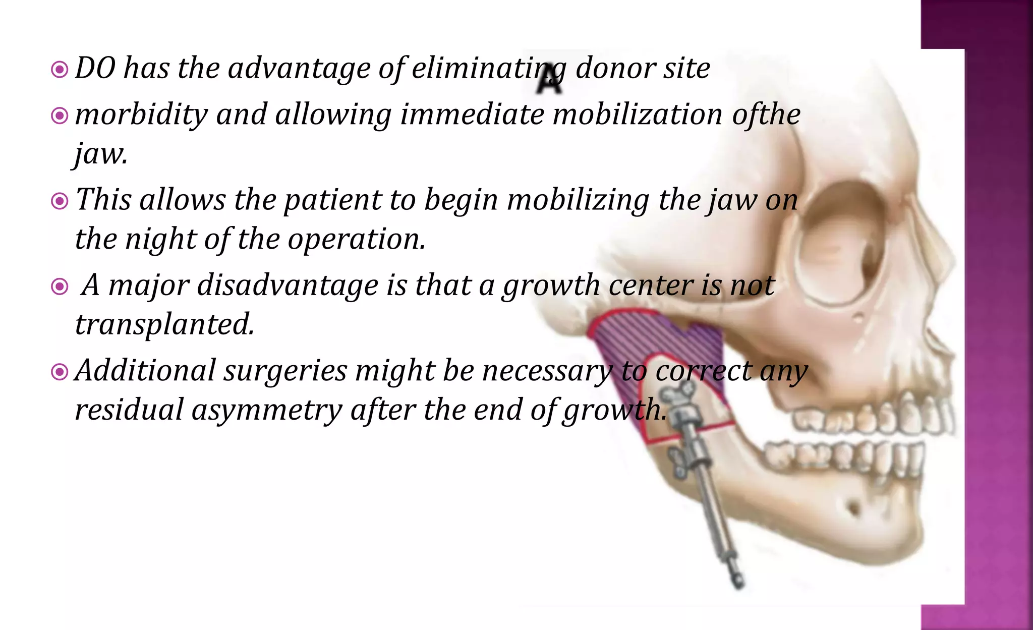 Kaban protocol tmj ankylosis treatment new 2009 | PPTX