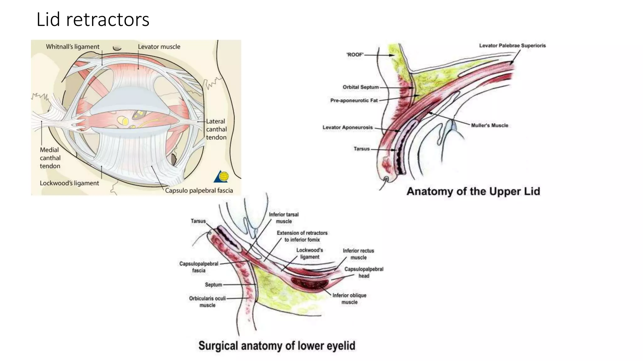 Ectropion and Entropion (Ophthalmology) - Etiology, Management | PPTX