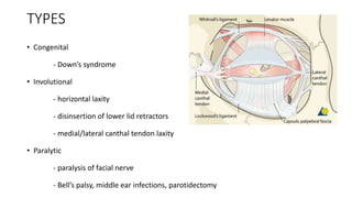 Ectropion and Entropion (Ophthalmology) - Etiology, Management | PPTX