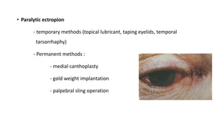 Ectropion and Entropion (Ophthalmology) - Etiology, Management | PPTX