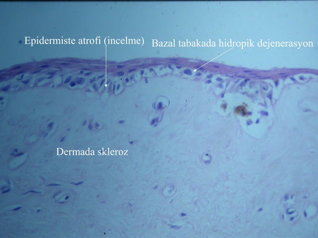 Kadin geni̇tal si̇stemi̇ pratiği | PPT