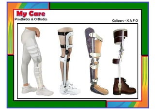 Kafo caliper for polio my care prosthetics and orthotics | PDF