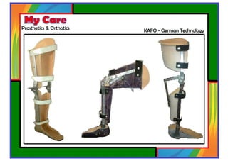 Kafo caliper for polio my care prosthetics and orthotics | PDF