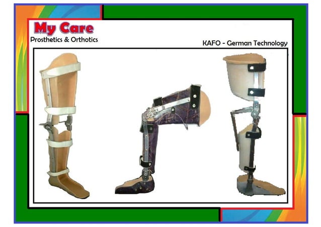 Kafo caliper for polio my care prosthetics and orthotics | PDF