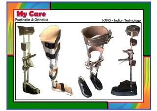 Kafo caliper for polio my care prosthetics and orthotics | PDF
