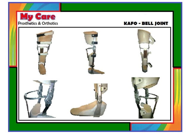Kafo caliper for polio my care prosthetics and orthotics | PDF