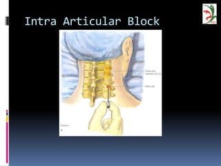 Neck Pain Treatment | PPT