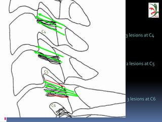 Neck Pain Treatment | PPTX