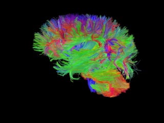 A tutorial in Connectome Analysis (1) - Marcus Kaiser | PDF