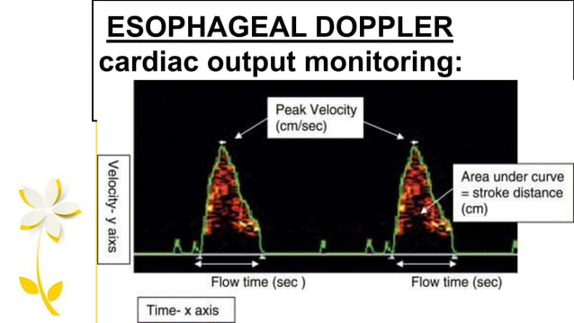 Cardiac Output Monitoring Pptx