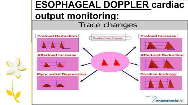 Cardiac Output Monitoring Pptx