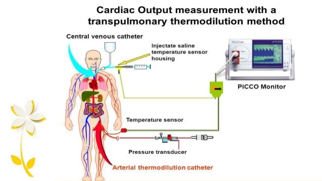 cardiac output monitoring