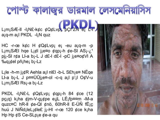 Kala azar presentation in bengali | PPT