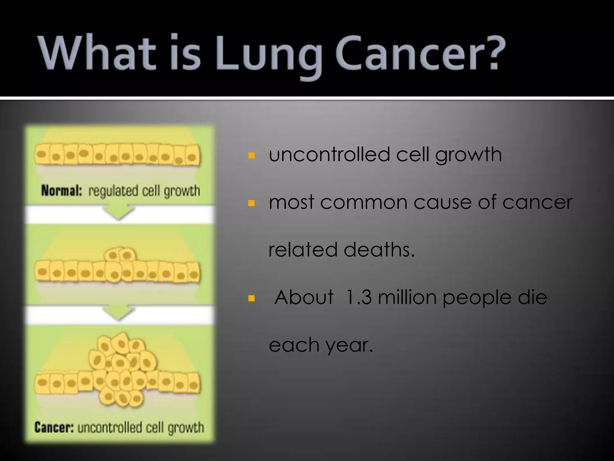 Lung Cancer | PPTX