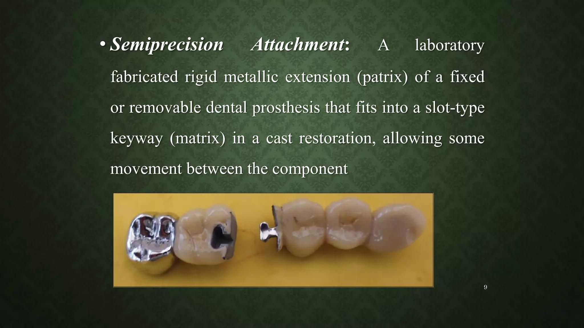 Kalpana stress breakers in rpd | PPTX