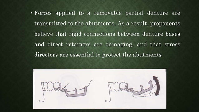 Kalpana stress breakers in rpd | PPTX | Oral care | Personal Care