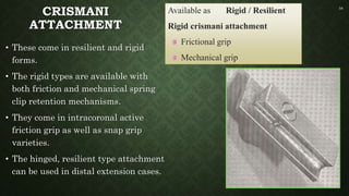 Kalpana stress breakers in rpd | PPTX