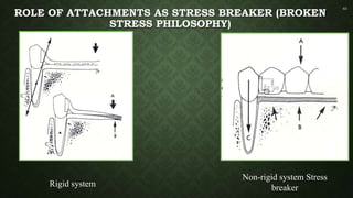 Kalpana stress breakers in rpd | PPTX