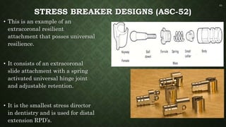 Kalpana stress breakers in rpd | PPTX