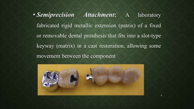Kalpana stress breakers in rpd | PPTX | Oral care | Personal Care