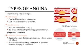 Screening methods of Antianginal Drug.pptx