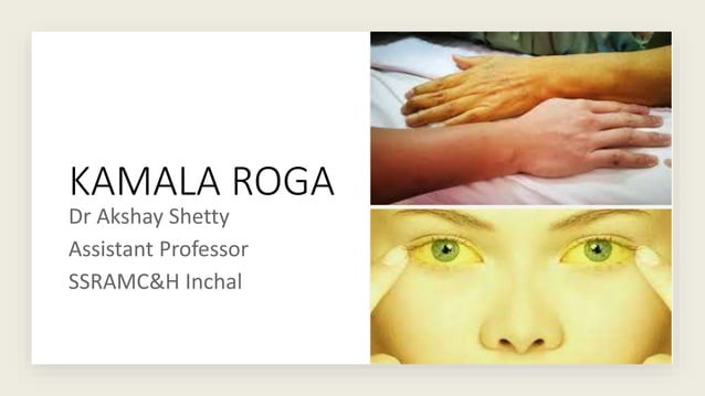 Kamala Roga | PPTX | Digestive Disorders | Diseases and Conditions