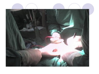 Kamar operasi (ok) | PPT