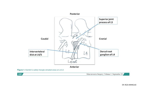 Kambins triangle vs ENR | PPTX