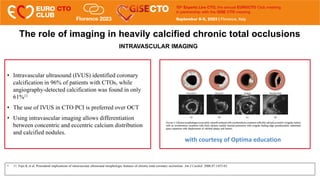 Kambis Mashayekhi: EuroCTO Consensus on treatment of Calcified CTO ...