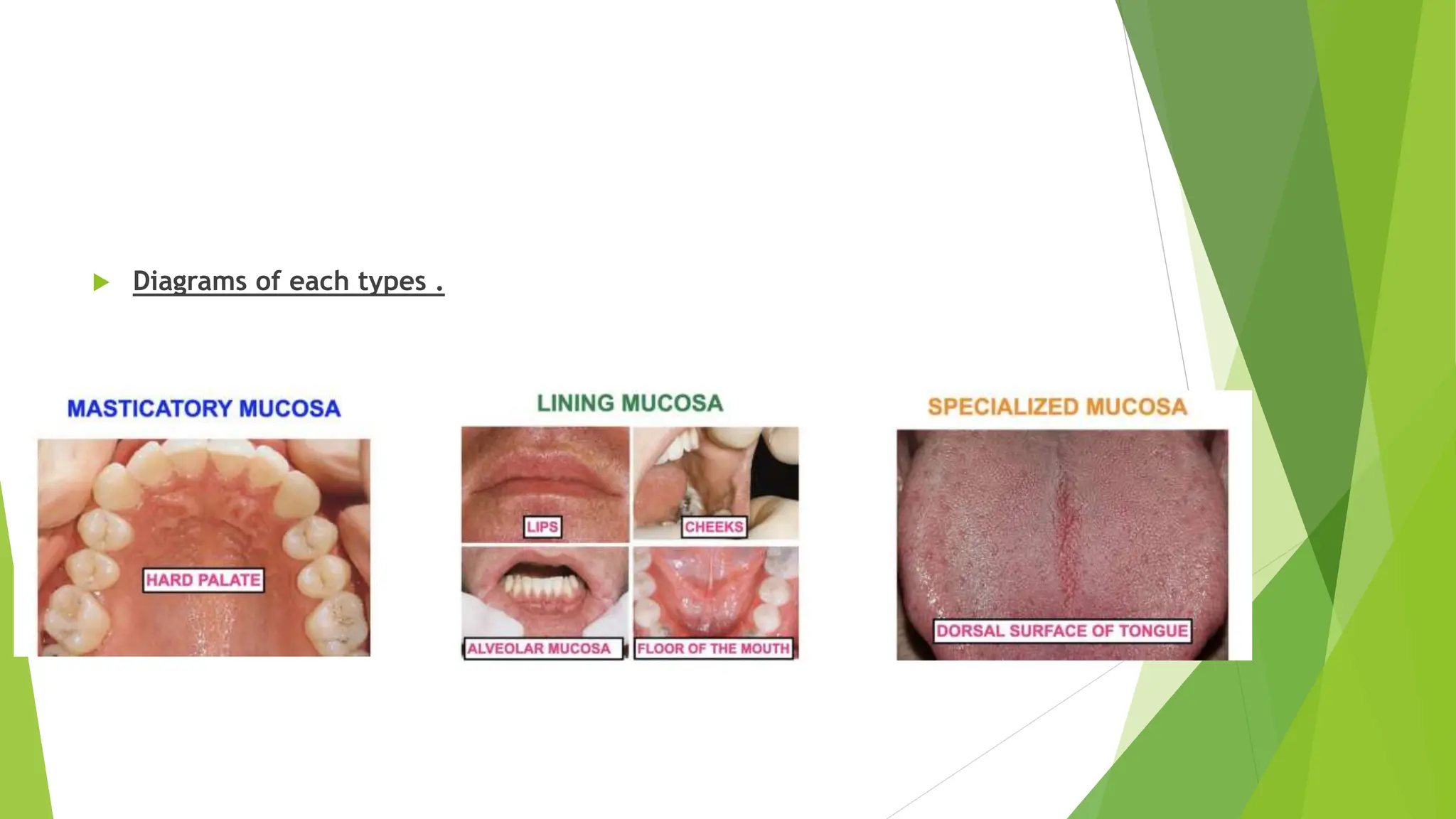 oral mucosa subdivisions histology of subdivisions | PPTX