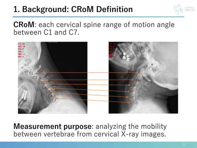 Cervical Spine Range of Motion Measurement Utilizing Image Analysis ...