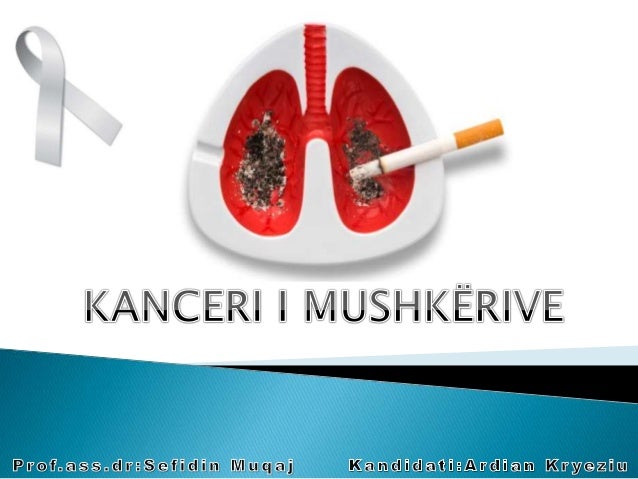 Kanceri i Mushkerise